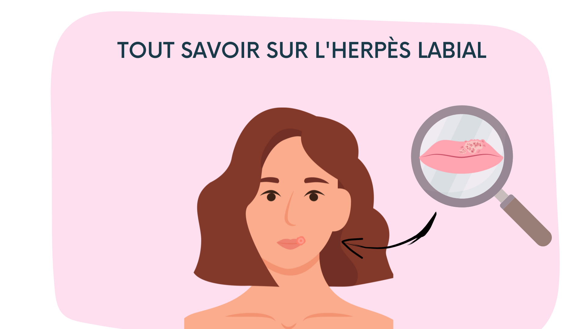 Tout savoir sur l'herpès labial | Blog - Doctoome